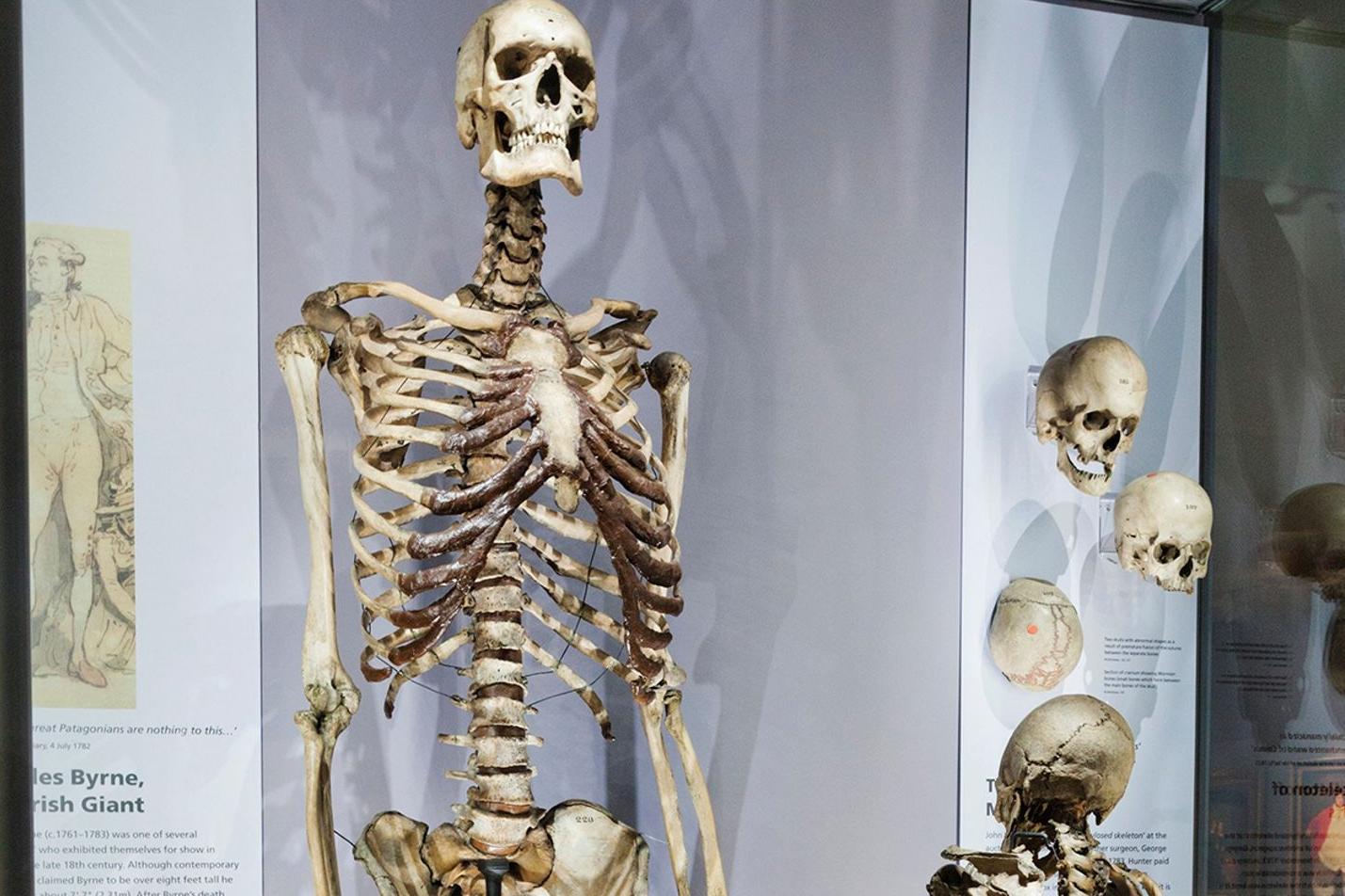 Лондонський музей сховав скелет «ірландського велетня», який боявся ...